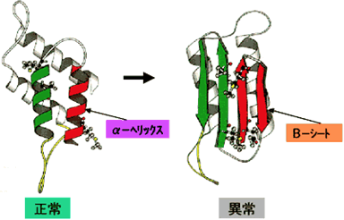 JACOP｜プリオン病について